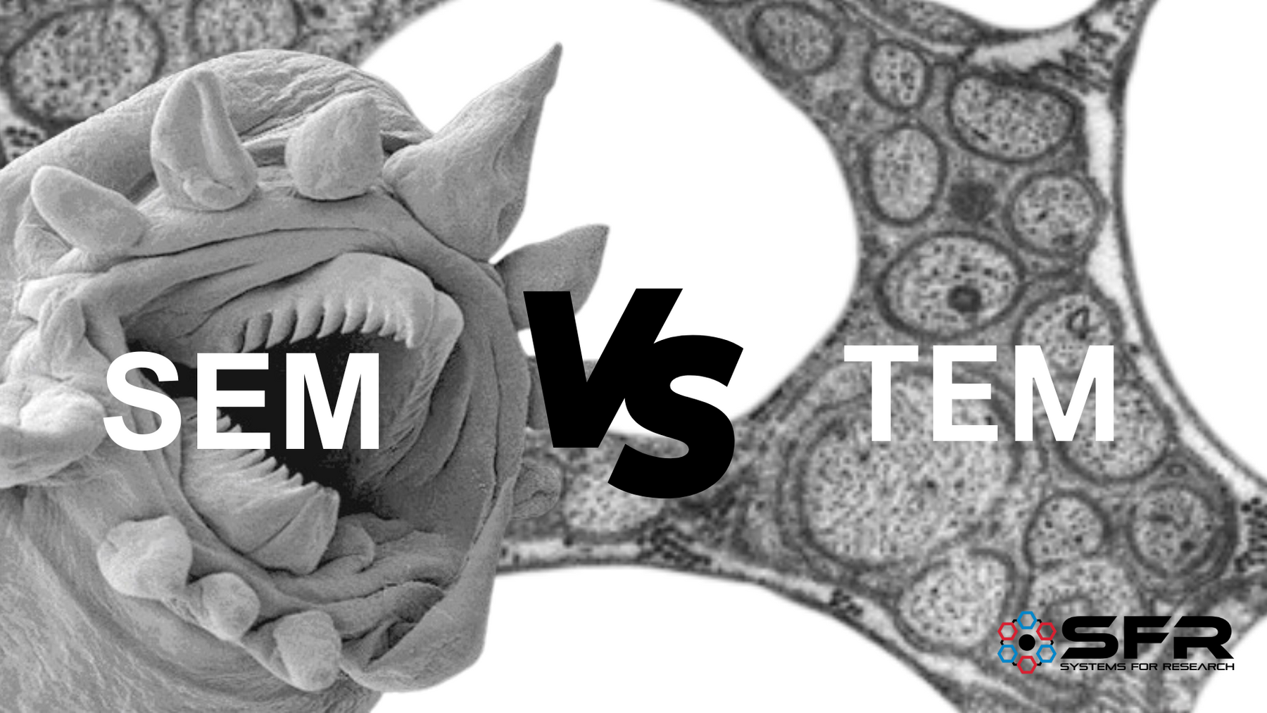 SEM VS TEM: Choosing the Right Electron Microscopy Technique - Systems ...